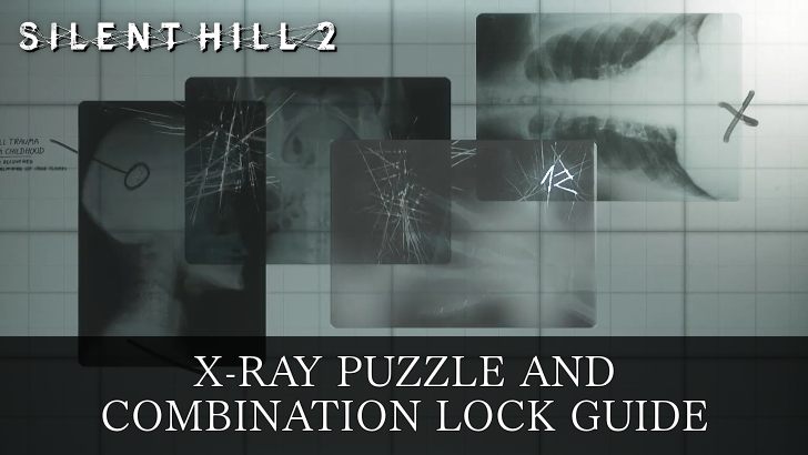 X Ray Pictures Silent Hill 2